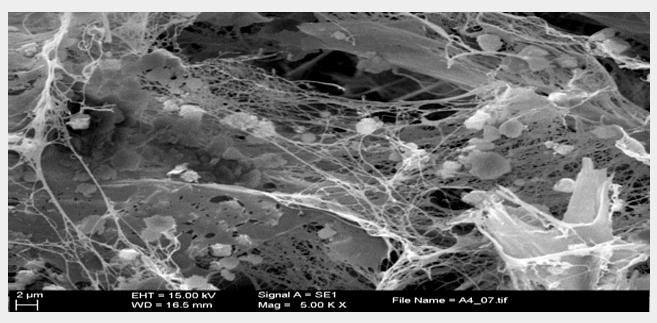 Stem Cells In Regenerative Medicine Avinent