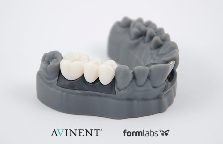 Formlabs 2: precise, affordable 3D printing - AVINENT