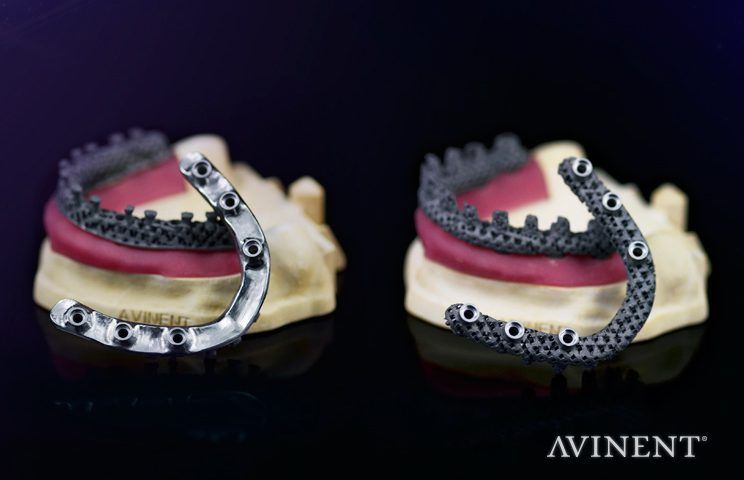 New sintered hybrid structures: another step forward in the field of ...